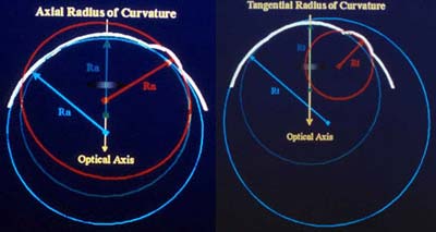 Instrument Basics Part III: Corneal Curvature | OphthalmologyWeb: The ...