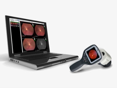 Volk Releases Pictor Workstation Software Platform | OphthalmologyWeb ...