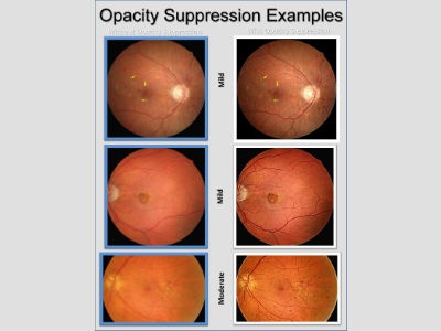 Canon Introduces Latest Version of imageSPECTRUM Image Management ...