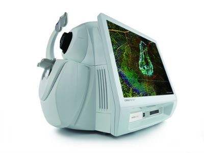Tech Spotlight: Zeiss AngioPlex OCT Angiography | OphthalmologyWeb: The ...