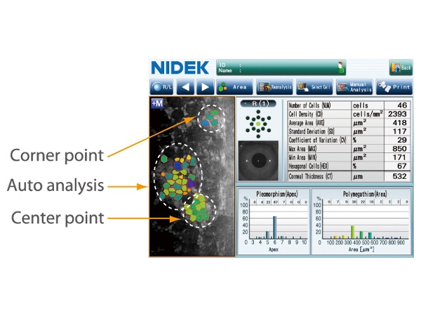 NIDEK Gains FDA Approval for Specular Microscope Manual Analysis ...
