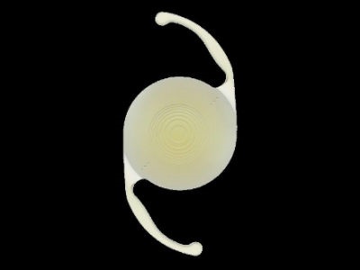 Alcon Receives FDA Approval for AcrySof IQ ReSTOR +2.5 Multifocal Toric ...