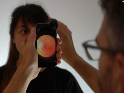 oDocs Introduce Slip Lamp and Retinal Camera Devices for Smartphones ...