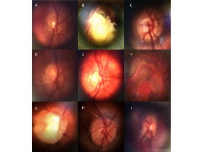 D-EYE Introduces ImageSelect, Shares Comparison Study ...