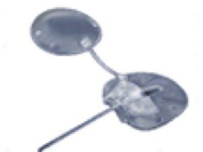 Ahmed™ Glaucoma Valve from New World Medical, Inc. - Product ...