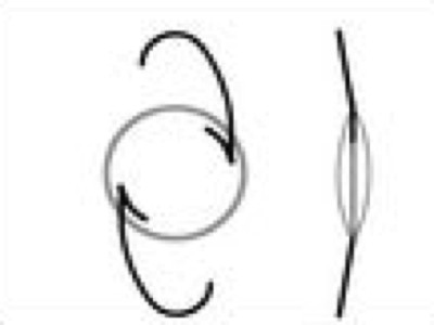 Silicone Intraocular Lenses (IOL) | OphthalmologyWeb: The Ultimate ...