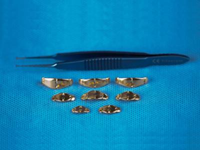 Gold Weighted Eyelid Implants | OphthalmologyWeb: The Ultimate Online ...