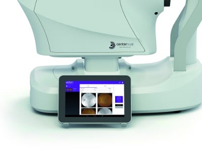 Eidon - True Color Confocal Scanner from CenterVue - Product ...