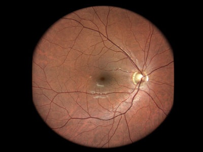 Eidon - True Color Confocal Scanner from CenterVue - Product ...