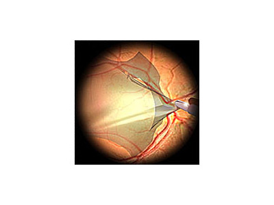 EYESI® Ophthalmosurgical Simulator from VRmagic GmbH - Product ...